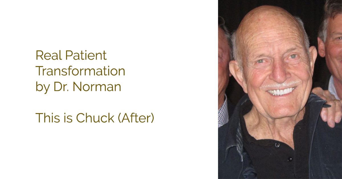 Patient Transformation - Chuck | Amy Norman, DDS - Everett, WA